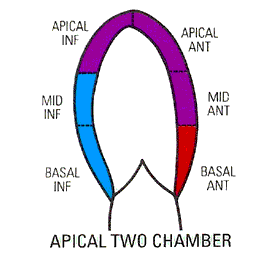 Wall Motion Score Index calculator
