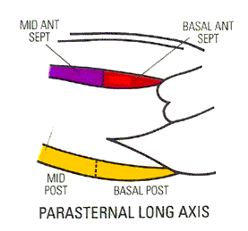 Wall Motion Score Index calculator